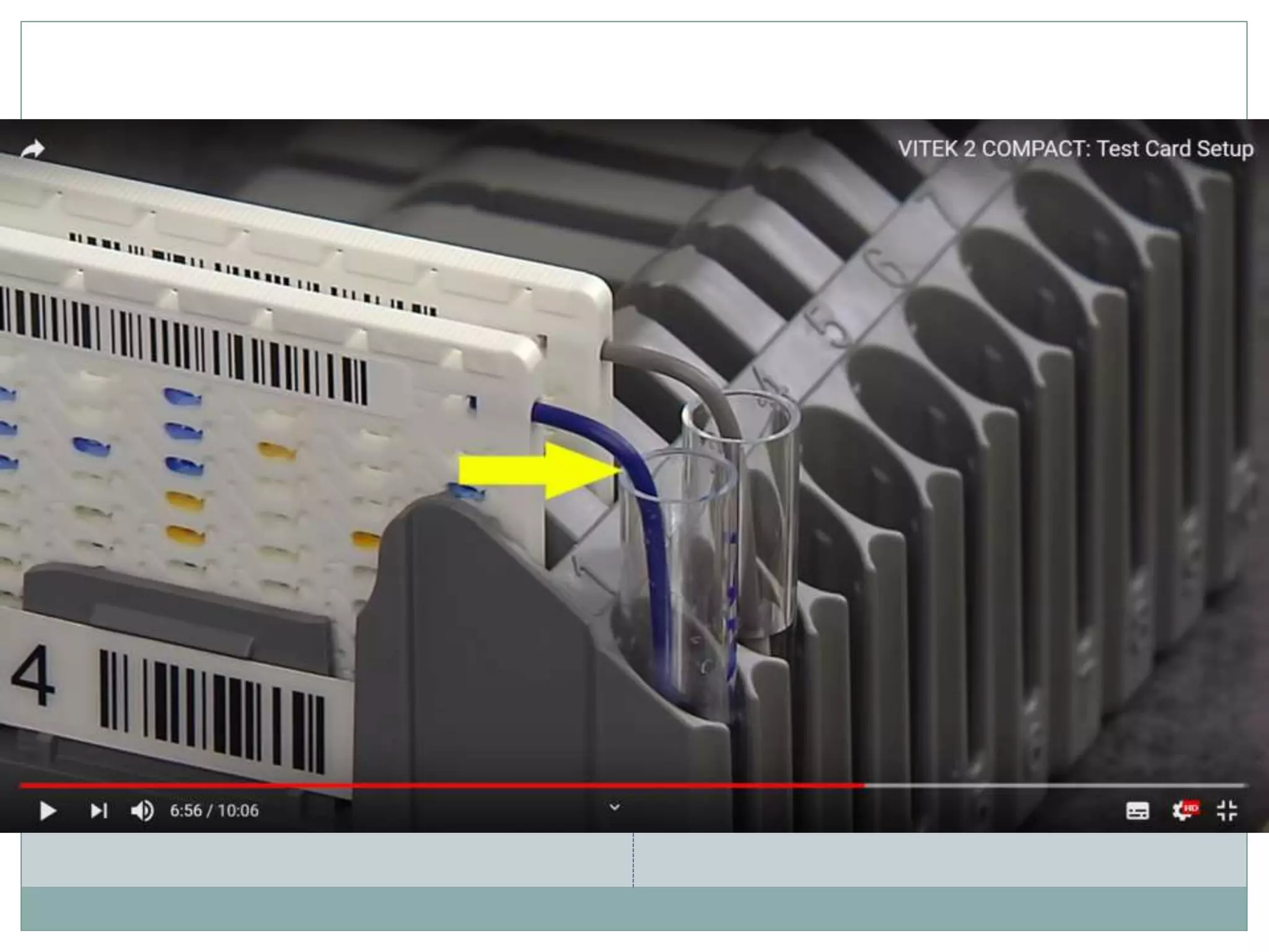 Vitek 2 compac tpptx | PPTX