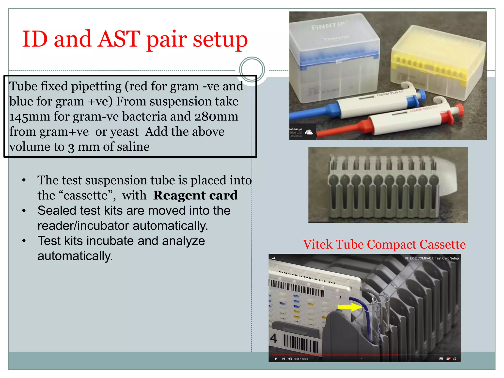 Vitek 2 compac tpptx | PPTX