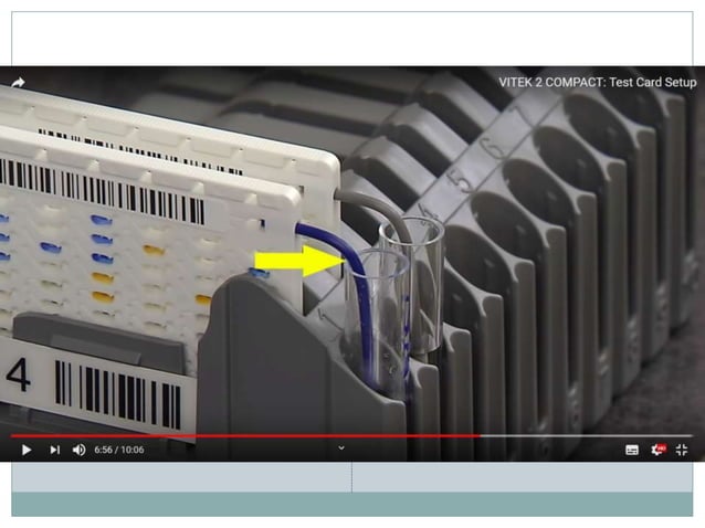 Vitek 2 compac tpptx | PPTX