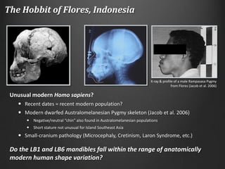 IPPA Cambodia talk - LB1 mandible | PPTX