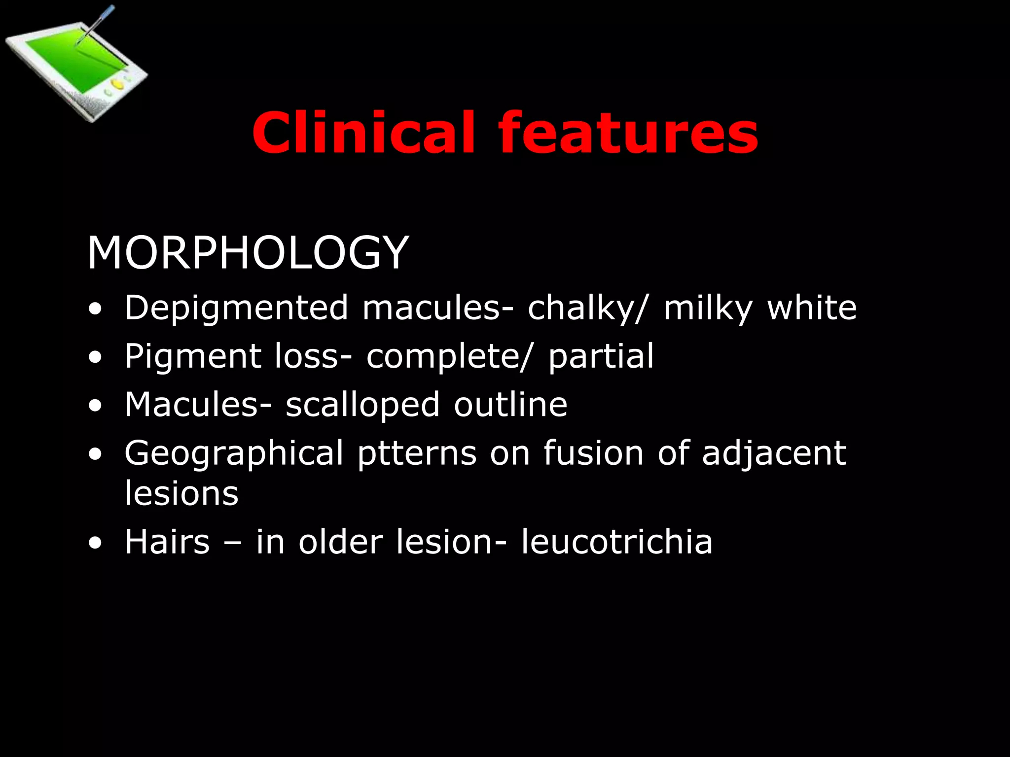Vitiligo | PPTX