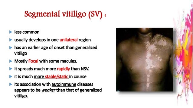 Vitiligo