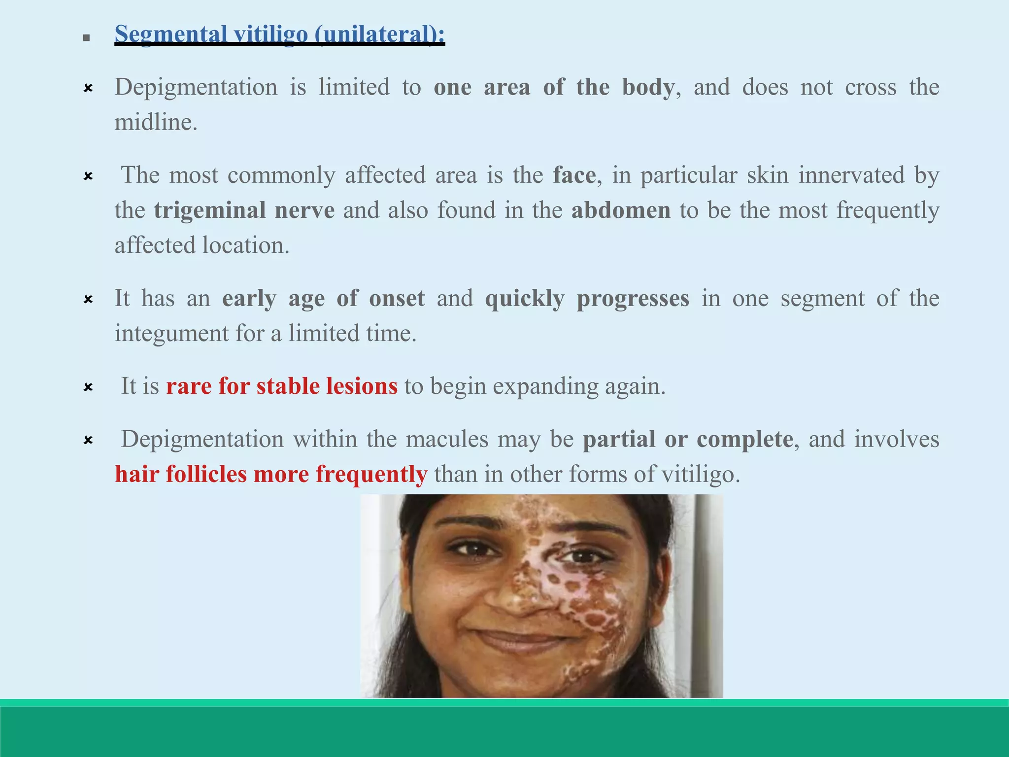 Vitiligo | PPTX