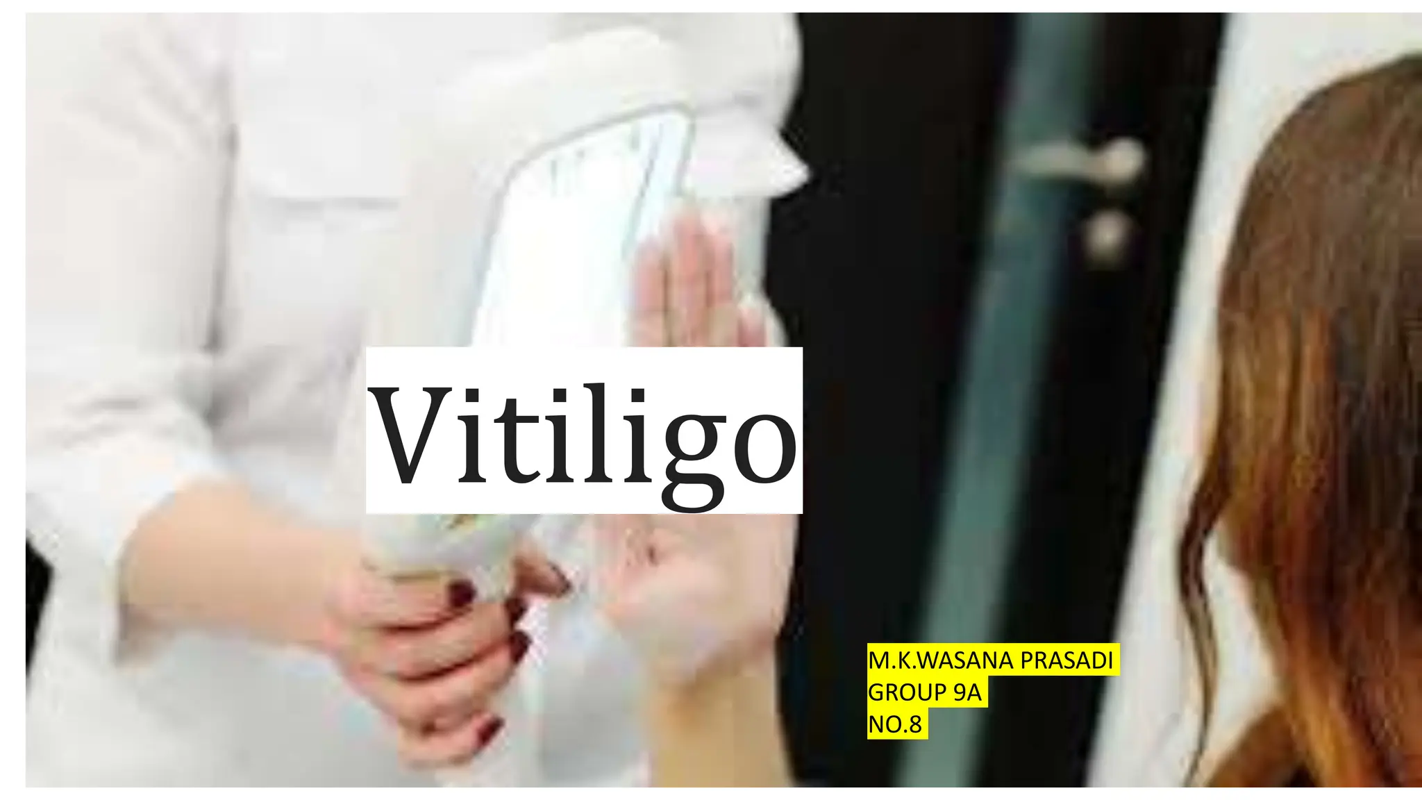 Vitiligo Pptx Psychiatric Patients Have Already Ppt