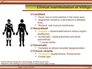 Vitiligo in association with Erythema dyschromicum perstans | PPT