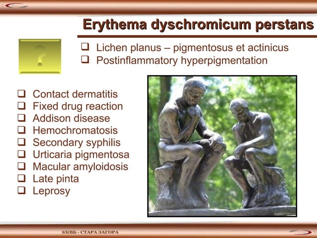 Vitiligo in association with Erythema dyschromicum perstans | PPT