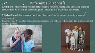 vitiligo presentation .pptx TOPIC VITILGO IN | PPTX