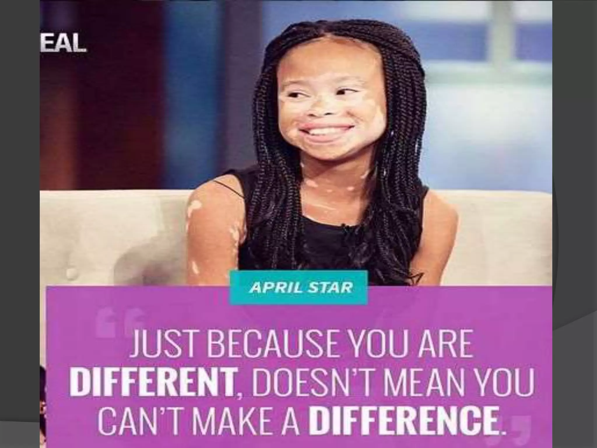 Vitiligo presentation | PPTX