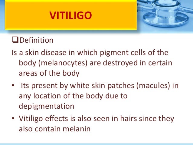 Vitiligo Definition