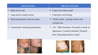 VITILIGO SURGERY.pptx