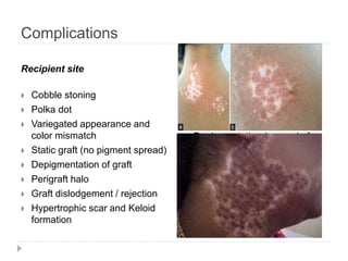 Vitiligo sx1 | PPTX