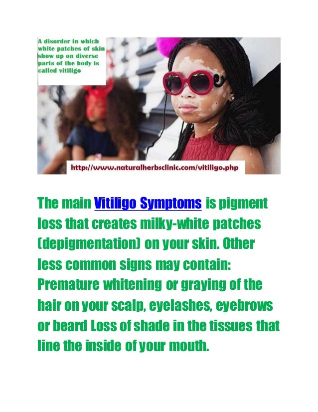 Vitiligo Symptoms And Signs