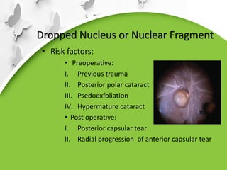 eye evaluation Vitrectomy - Anterior segment.pdf