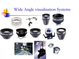 Vitrectomy Principles | PPT