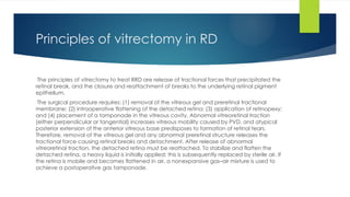 BASICS OF VITRECTOMY ,INSTRUMENTS,STEPS , | PPTX