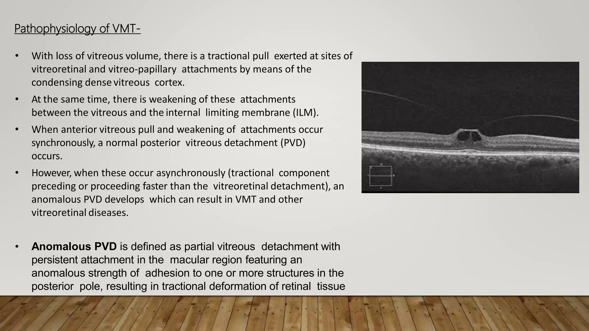 Vitreo macular interface disorder | PPTX