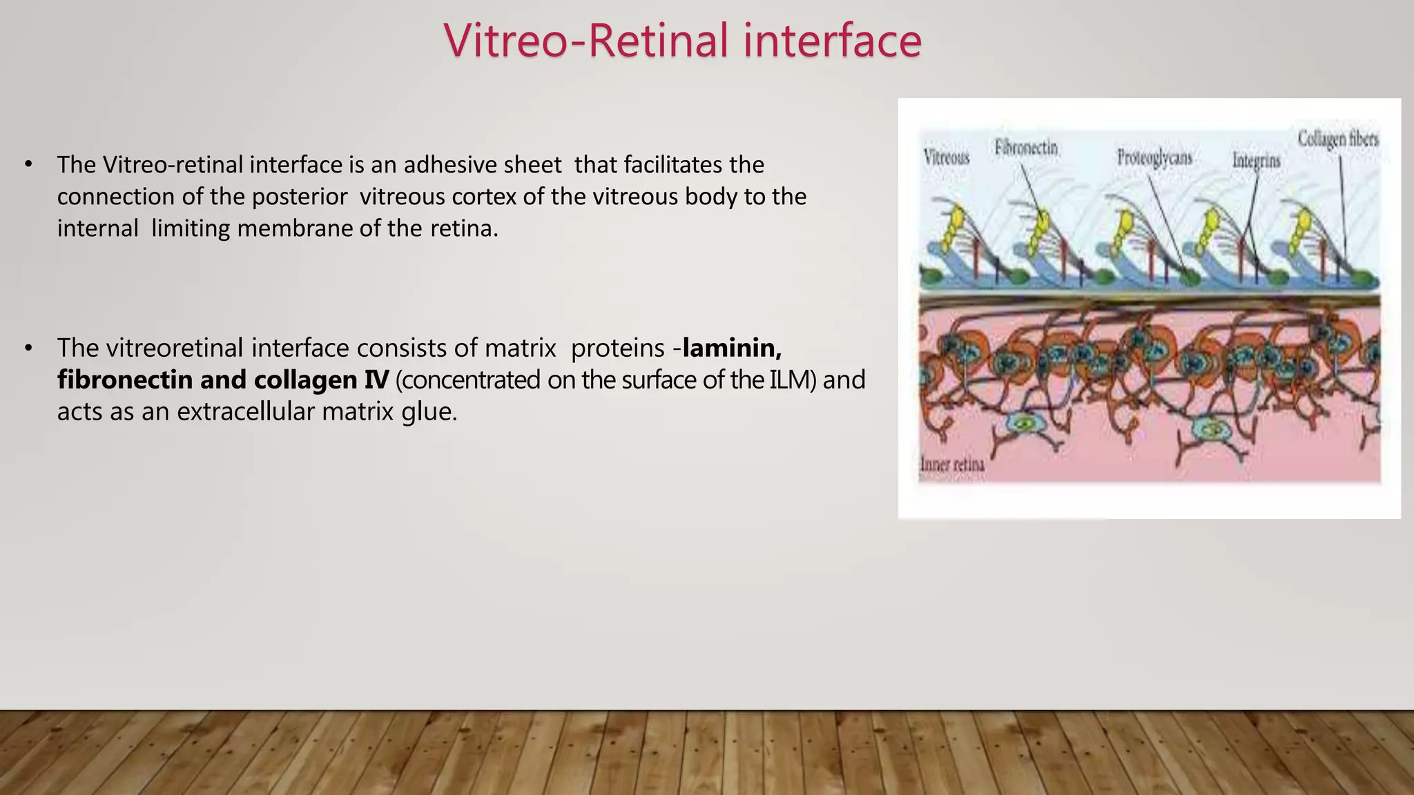 Vitreo macular interface disorder | PPTX