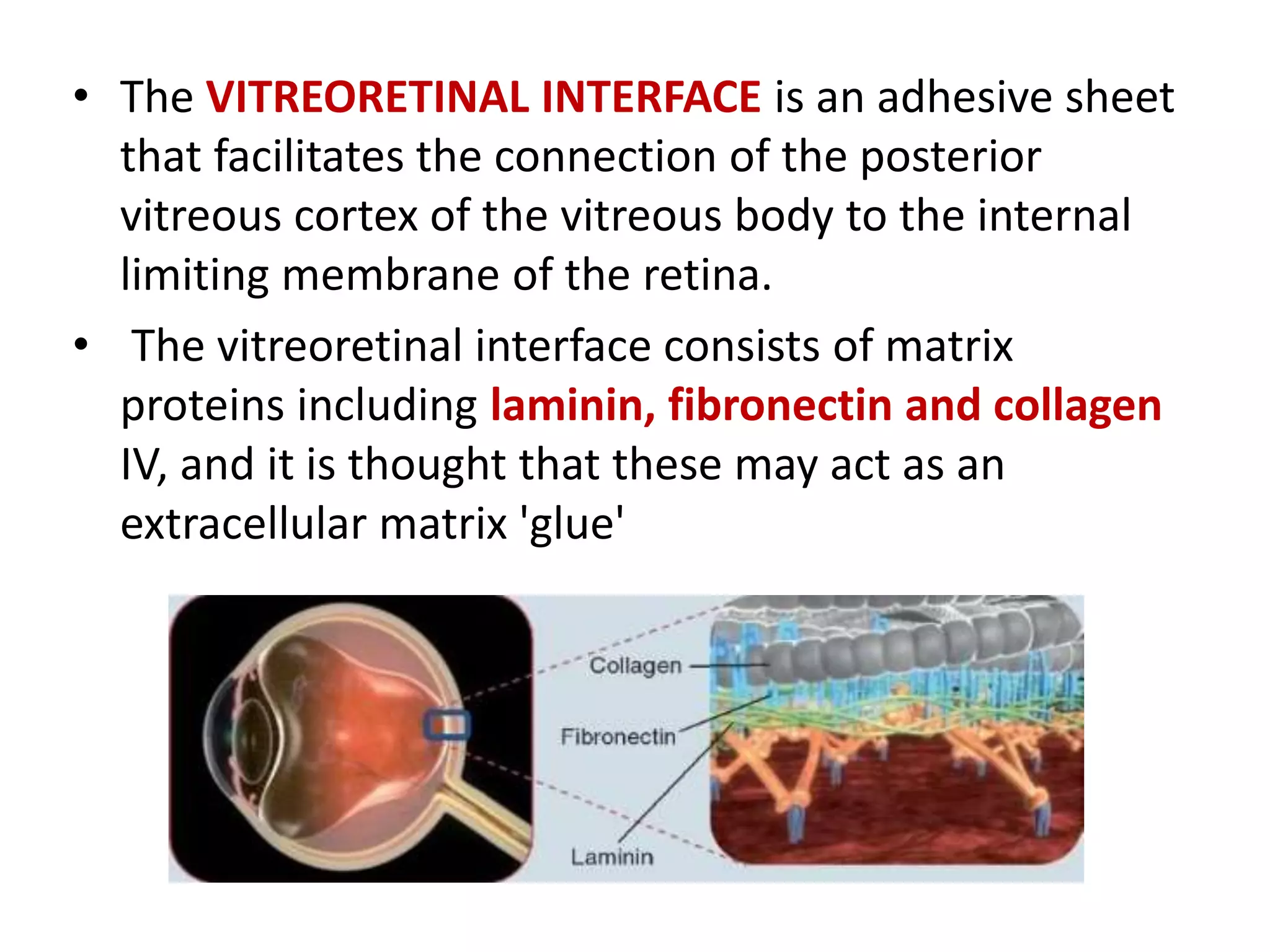 Vitreomacular traction | PPTX