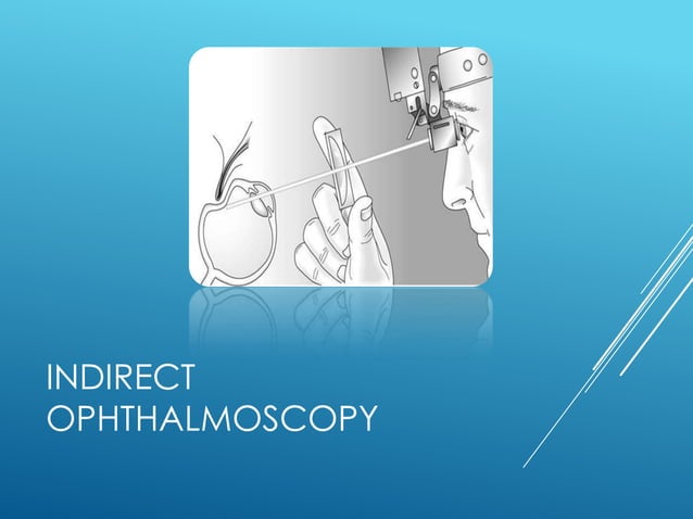 Vitreoretinal pathology (shared using VisualBee) | PPTX