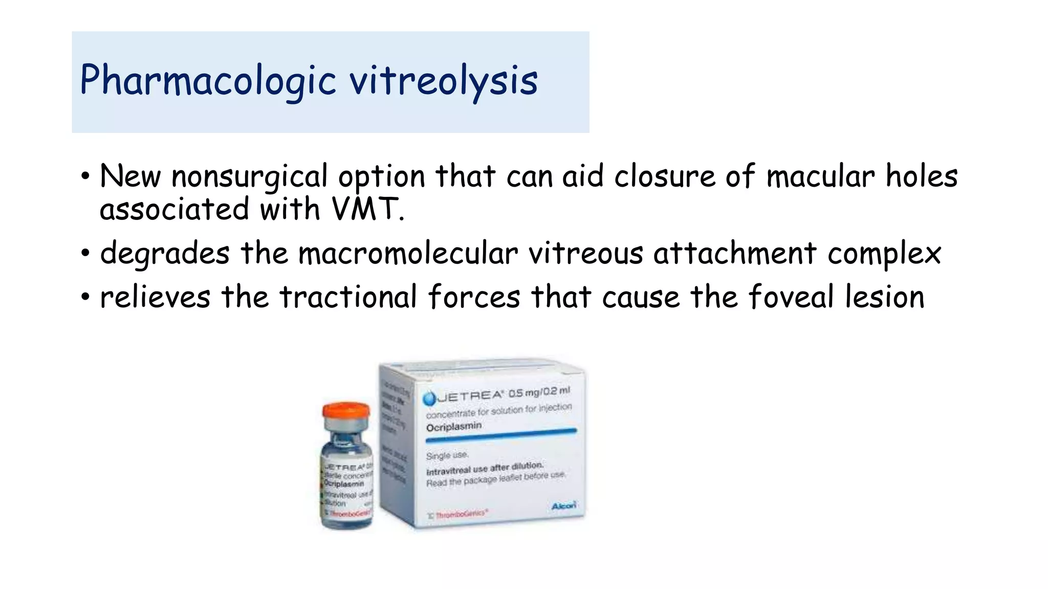 Vitreoretinal interface disorders | PPTX