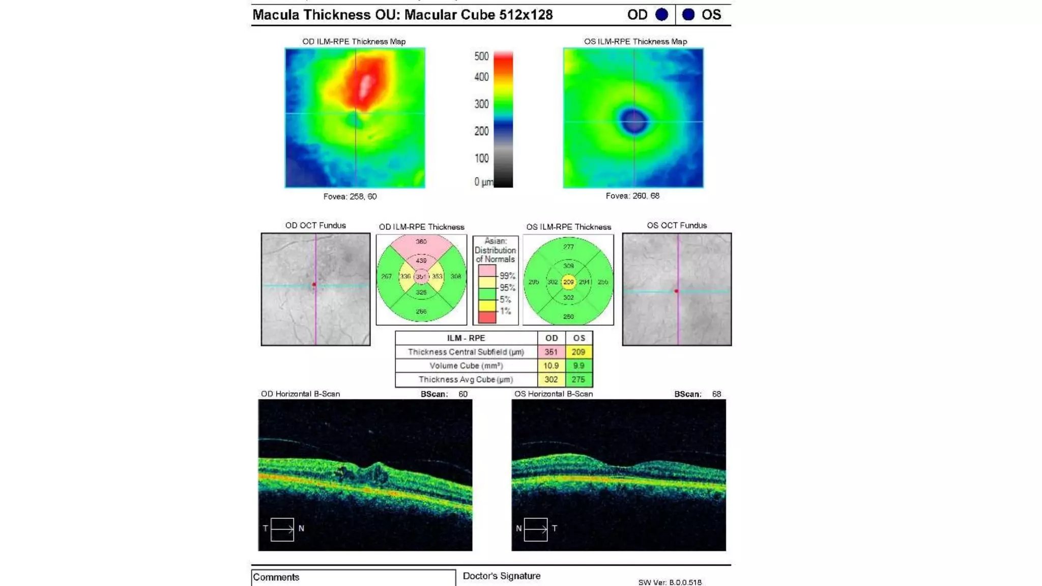 Vitreoretinal interface disorders | PPTX