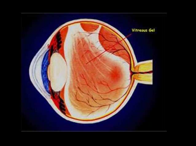 Vitreous | PPTX | Eye and Vision Conditions | Diseases and Conditions