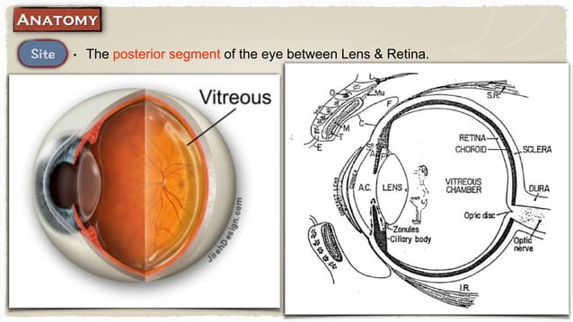 Vitreous | PPT