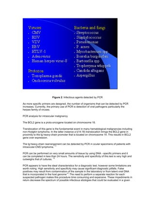 Vitreous biopsy in_the_diagnosis_of_uveitis | PDF