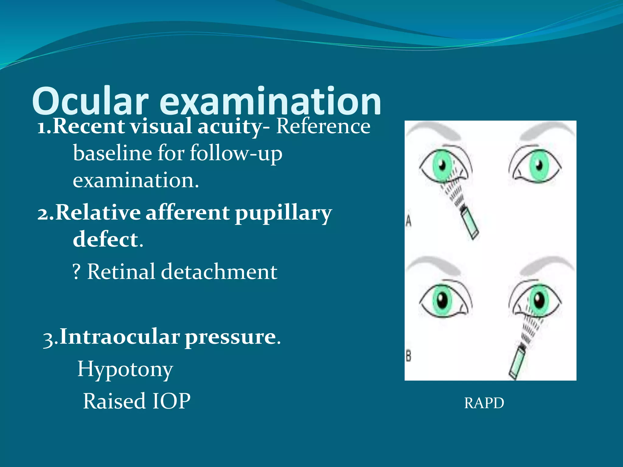 Vitreous hemorrhage | PPTX