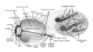 Vitreous humour of eye | PPTX | Eye and Vision Conditions | Diseases ...
