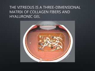 Vitreous new.pptx 1 | PPTX