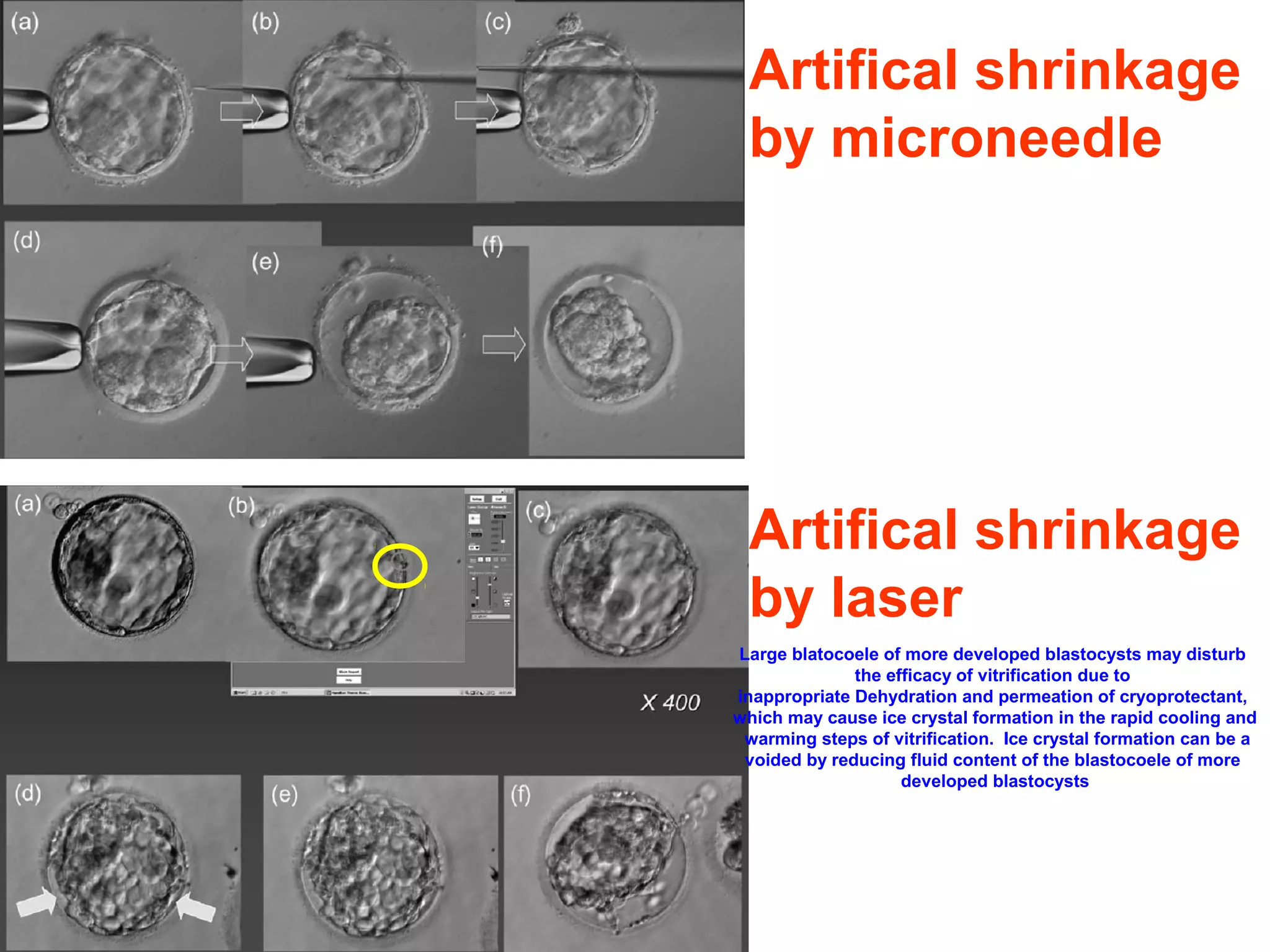Vitrification of blastocyst stage embryos | PPT