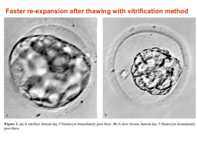 Vitrification of blastocyst stage embryos