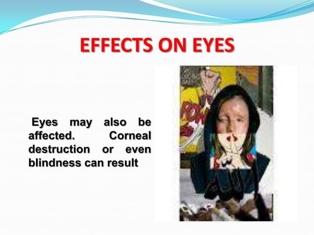 Vitriolage | PPTX | Skin and Dermatology | Diseases and Conditions