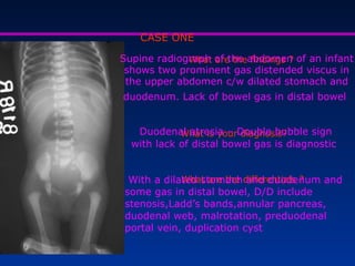 Viva segment 1 | PPT