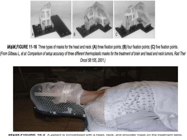 Intensity-modulated Radiotherapy | PPTX | Cancer | Diseases and Conditions