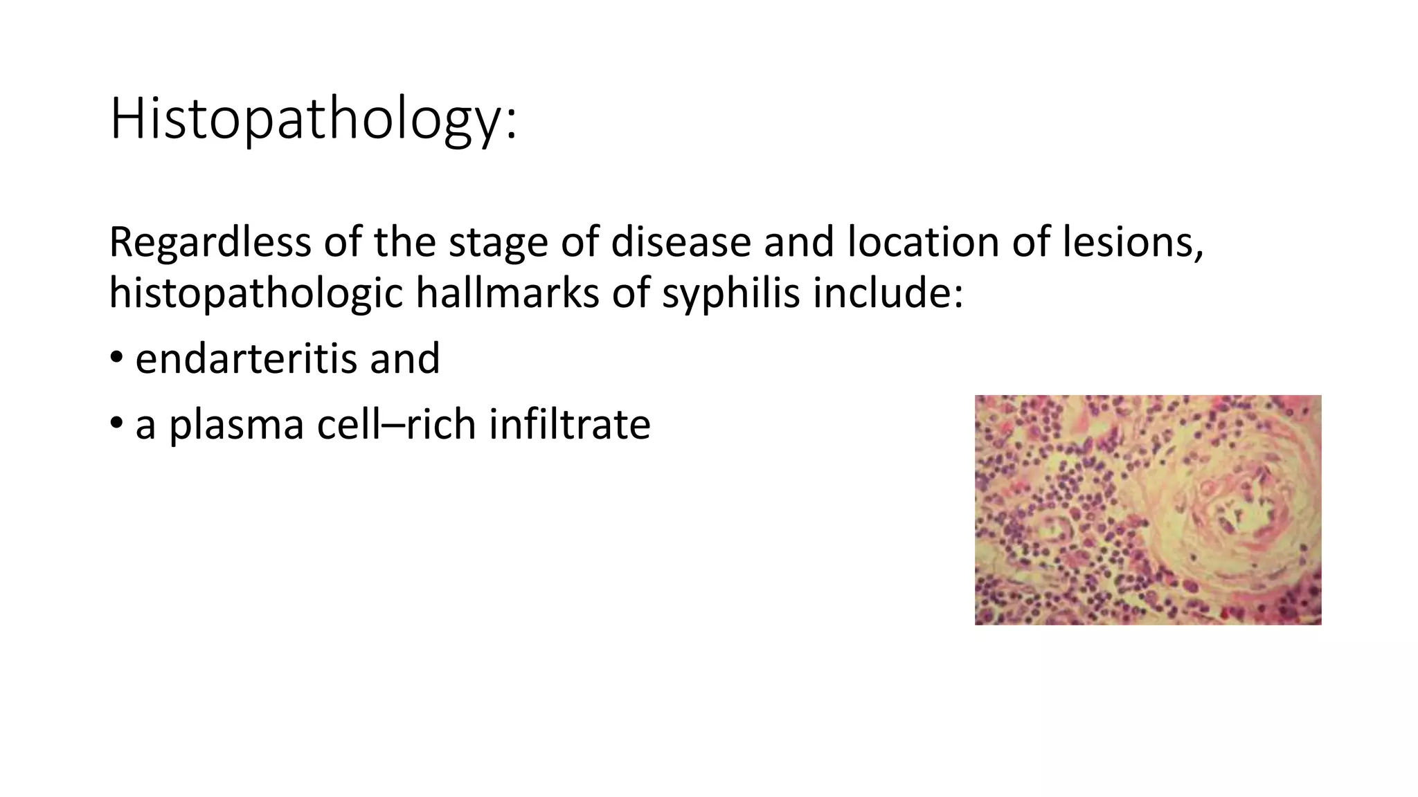 10th lecture syphilis | PPTX