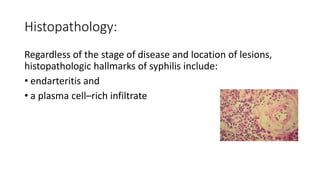 10th lecture syphilis | PPTX
