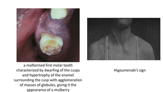10th lecture syphilis | PPTX