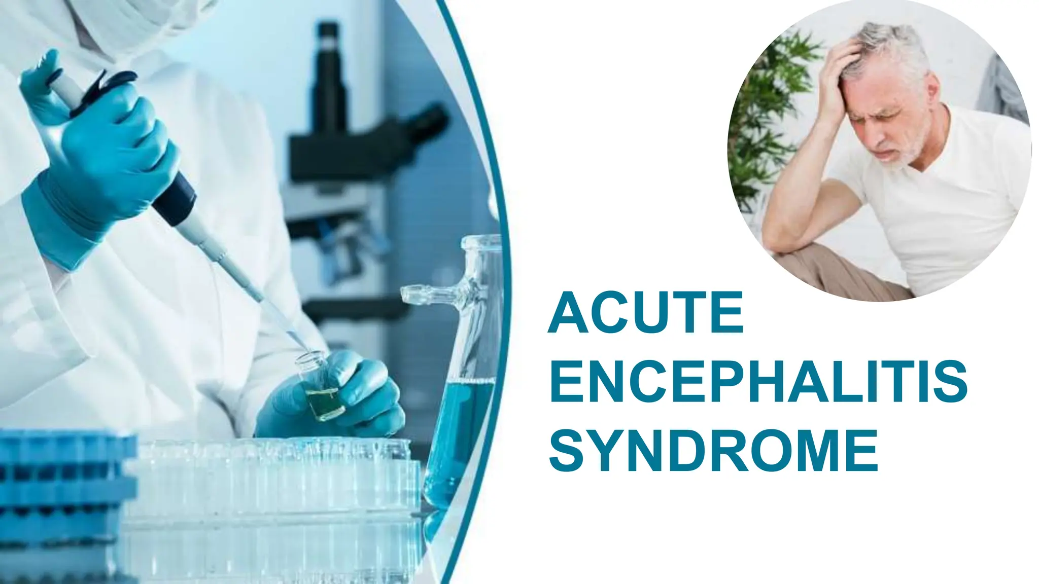 acute encephalitis syndrome | PPTX