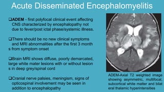 acute encephalitis syndrome | PPTX