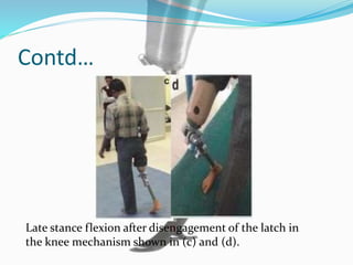 Designof a fully passive prosthetic knee | PPTX