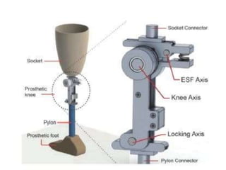 Designof a fully passive prosthetic knee | PPTX