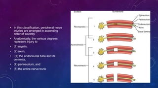 Damage Of Peripheral Nerve | PPTX