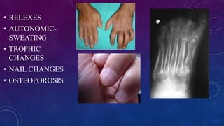 Damage Of Peripheral Nerve | PPTX