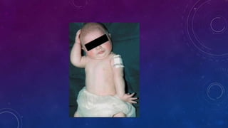Damage Of Peripheral Nerve | PPTX