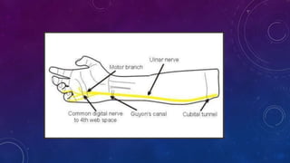 Damage Of Peripheral Nerve | PPTX