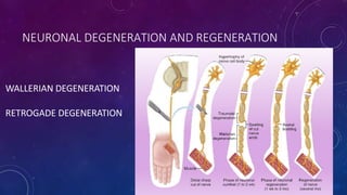 Damage Of Peripheral Nerve | PPTX