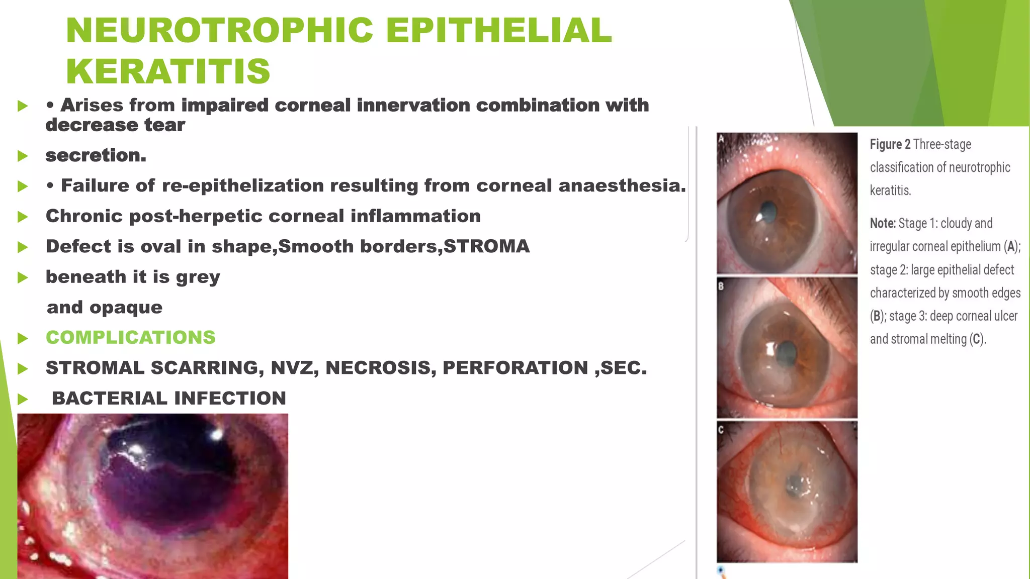 Viral Keratitis.pdf