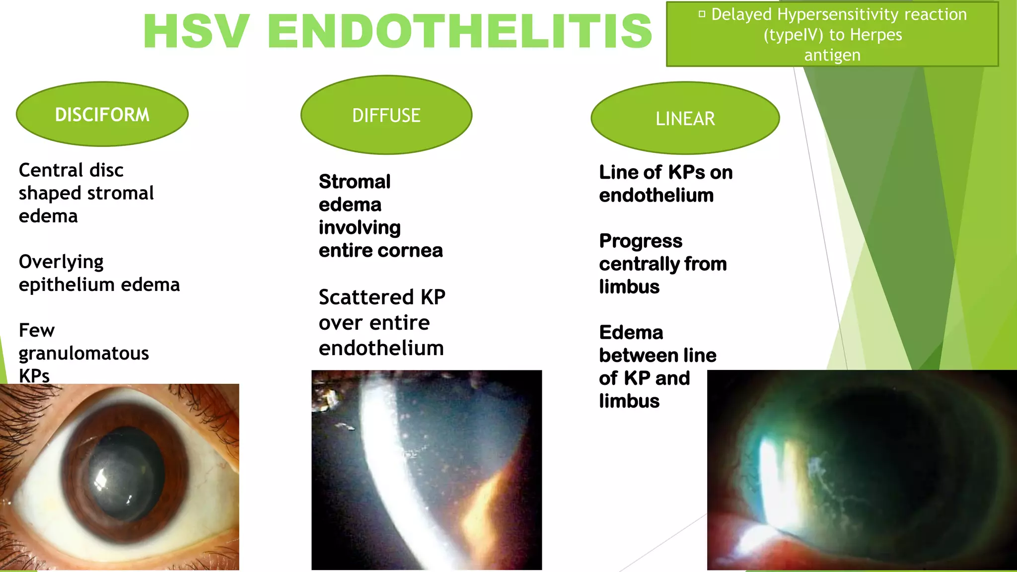 Viral Keratitis.pdf